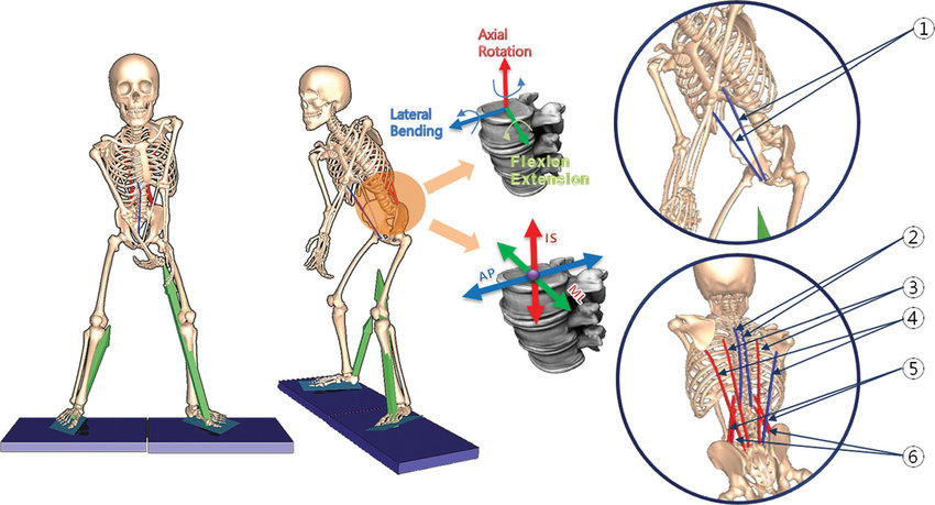 Bạn có đang tạo ra sự mất cân bằng cơ bắp?